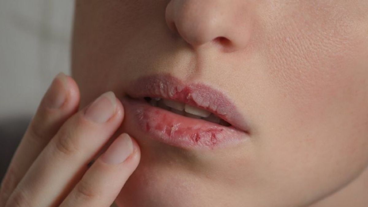 ¿Boca reseca?: cómo cuidar tus labios este invierno