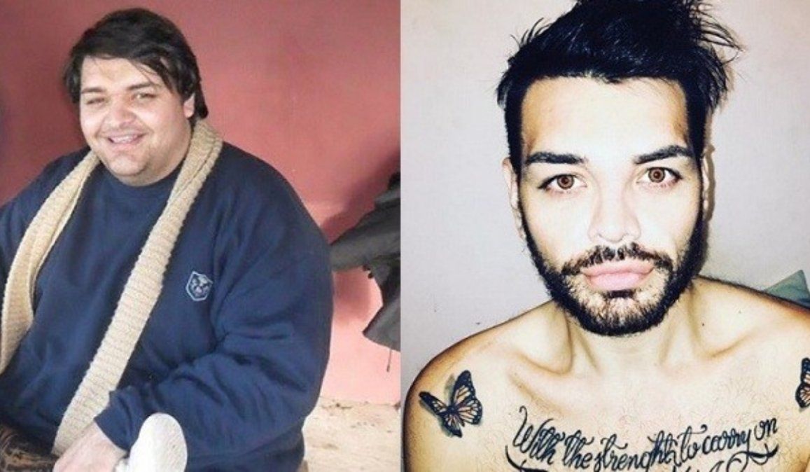 Fran Mariano, el ex Cuestión de peso, se operó más de 28 veces para ...