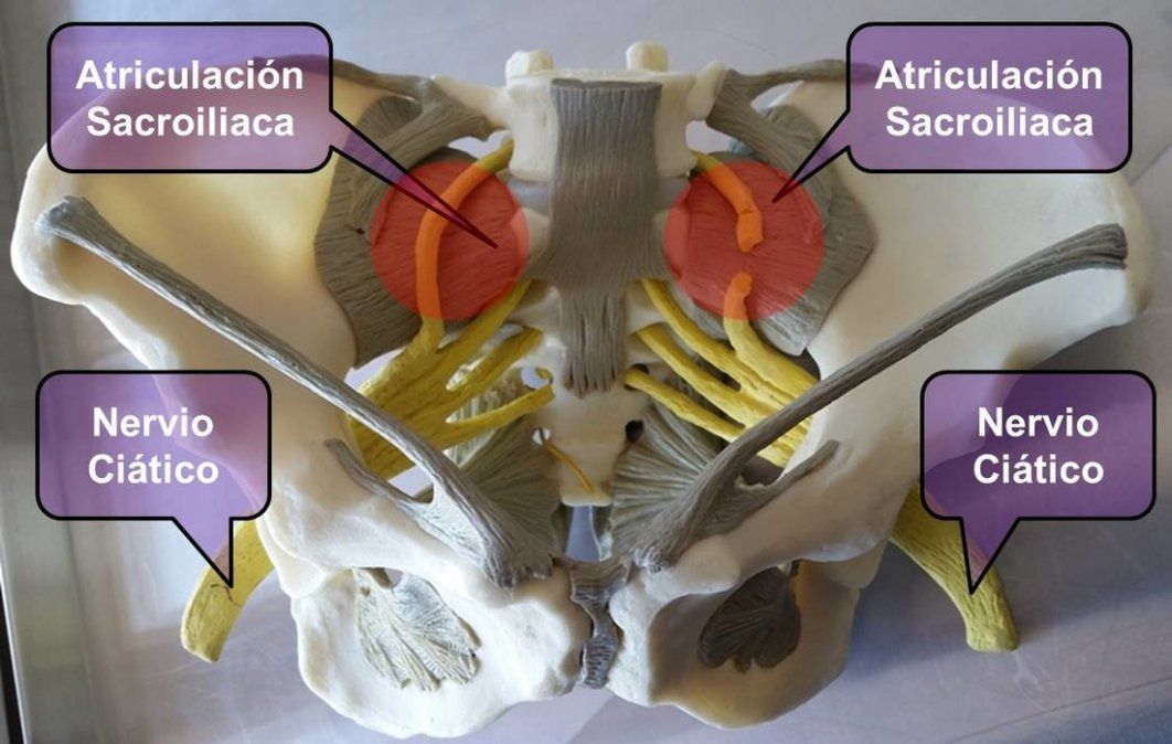 Ejercicios de la articulación sacroilíaca para el dolor ciático
