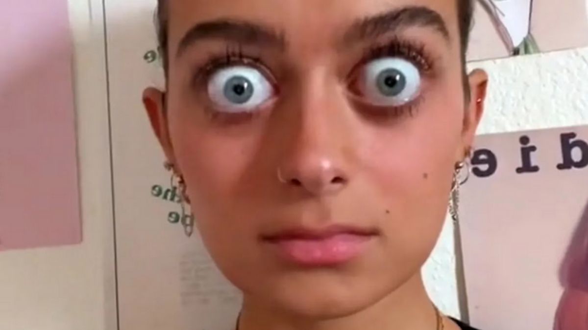 Arrasa en TikTok por el tamaño de sus ojos: Me llaman Gollum