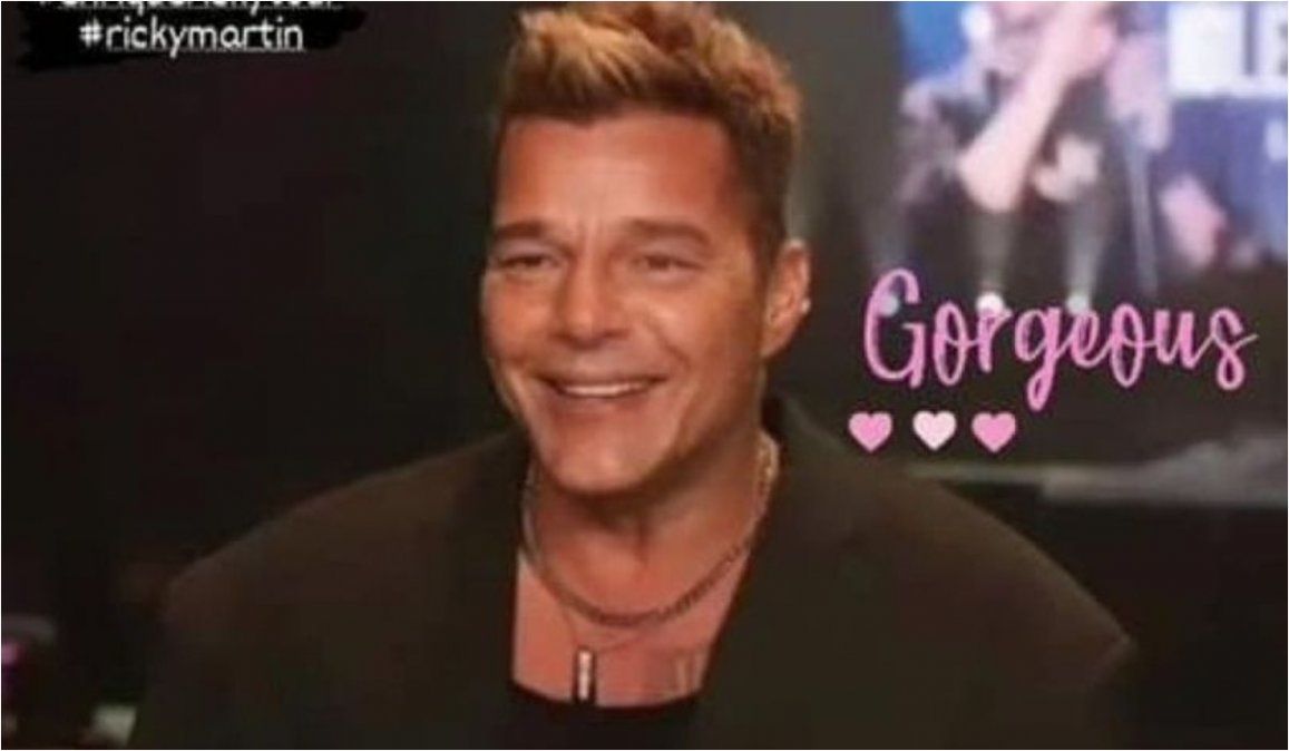 Estallaron los memes por el nuevo rostro de Ricky Martin