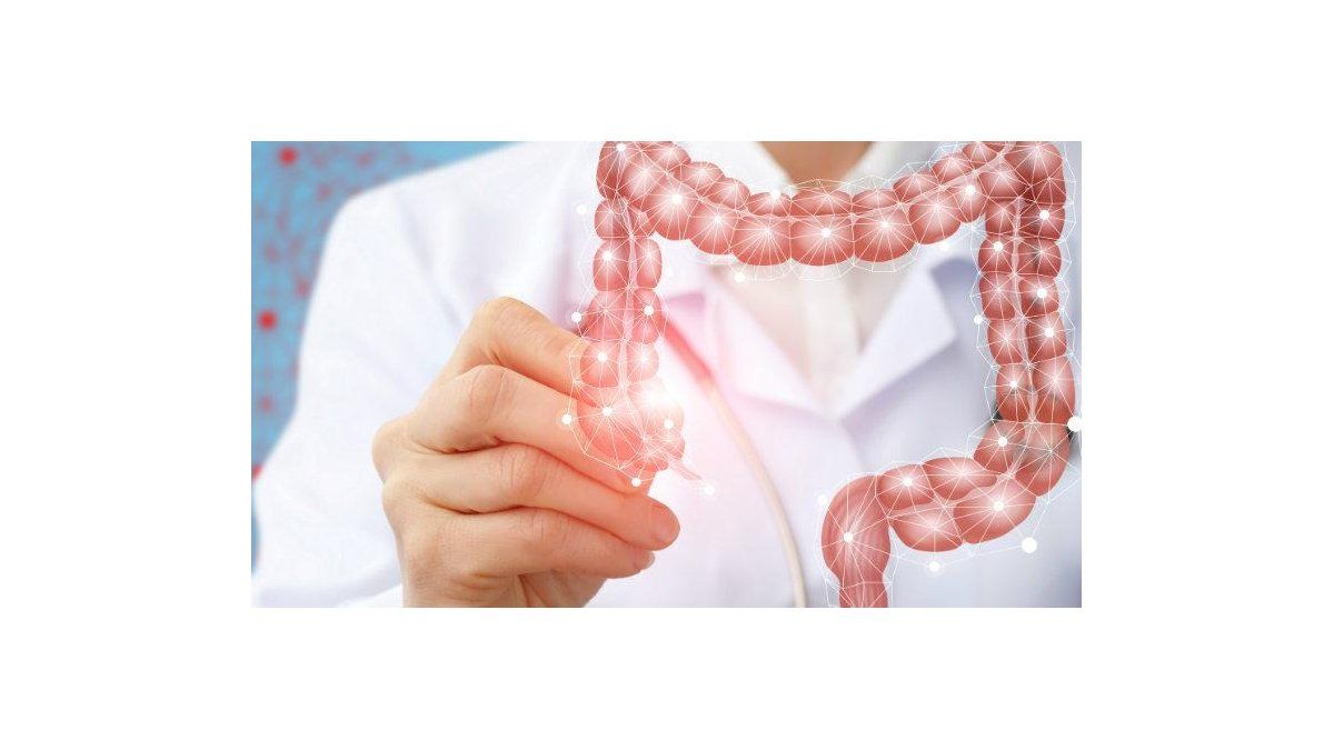 Cáncer de Colon: 9 de cada 10 personas se puede curar si se detecta a ...