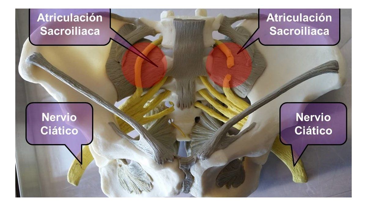 Ejercicios de la articulación sacroilíaca para el dolor ciático